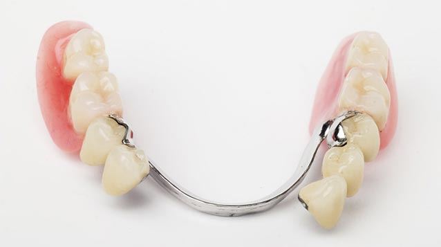 Partials for Missing Teeth in Santa Clarita